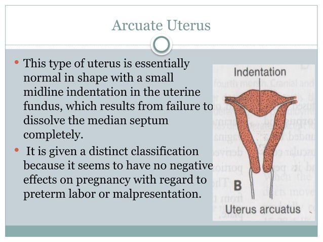 Disorders of the uterus presentation.pptx