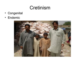 Disorders of thyroid gland copy | PPT