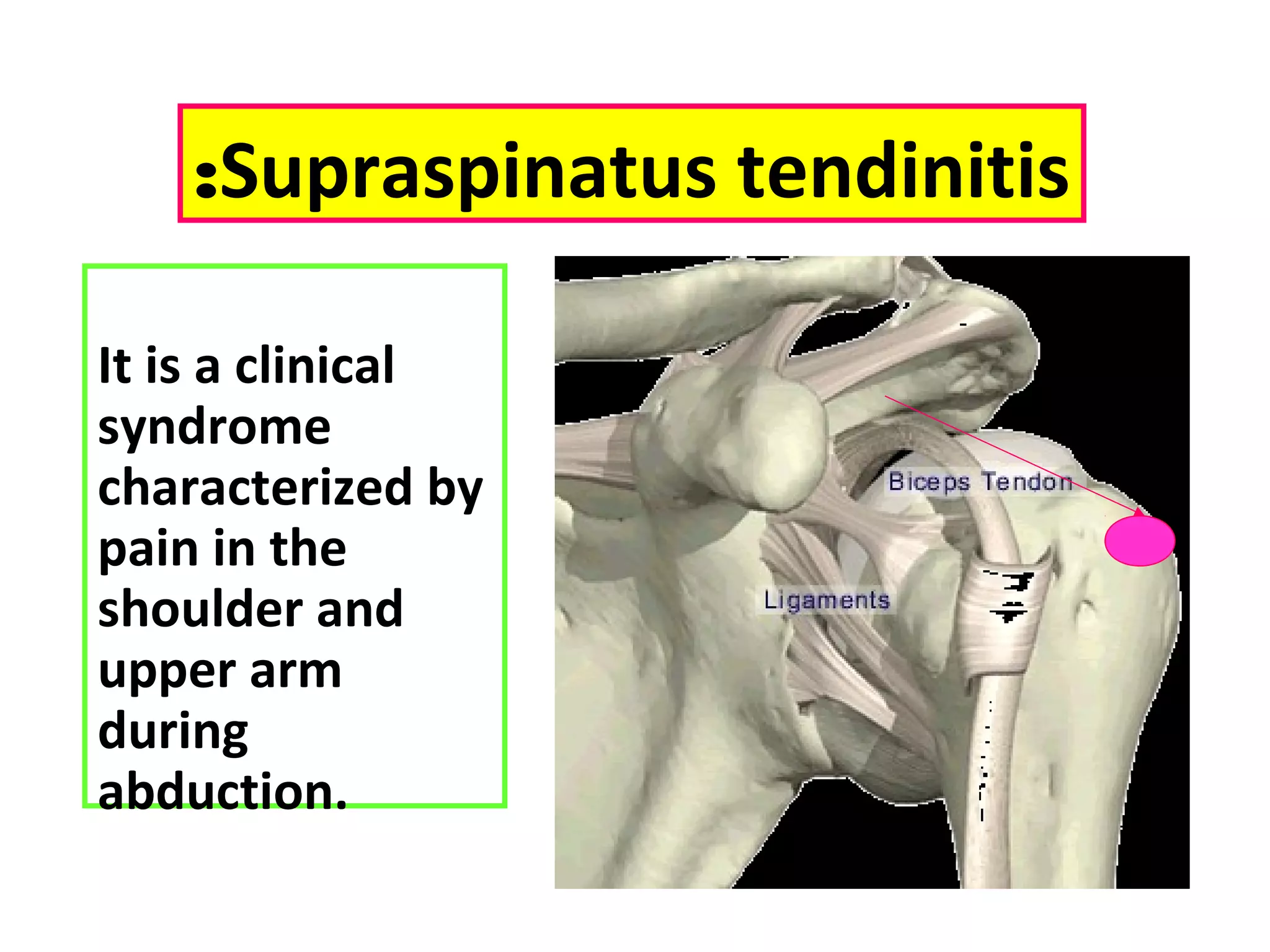 Disorders of upper limb | ODP