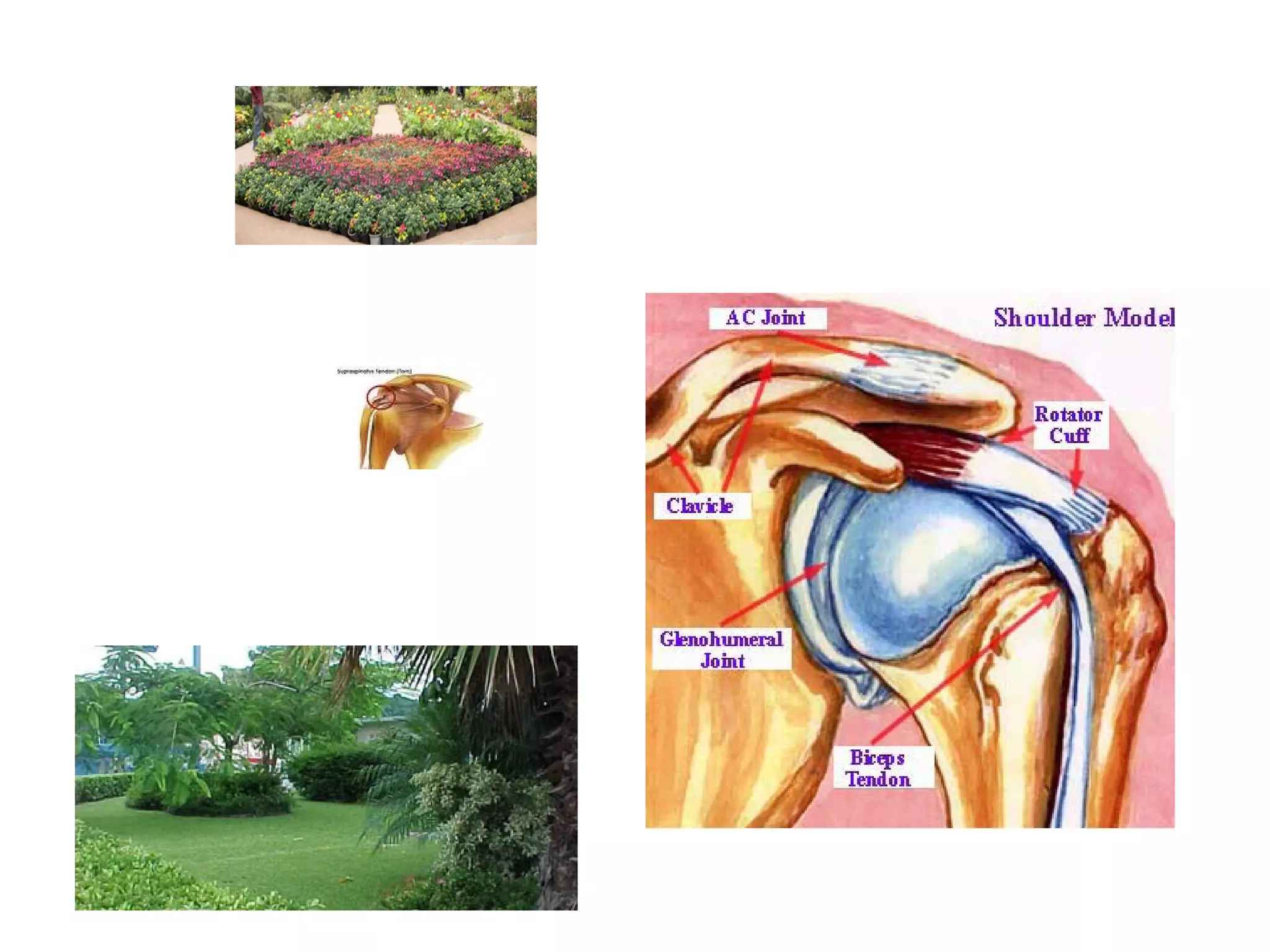 Disorders of upper limb | ODP