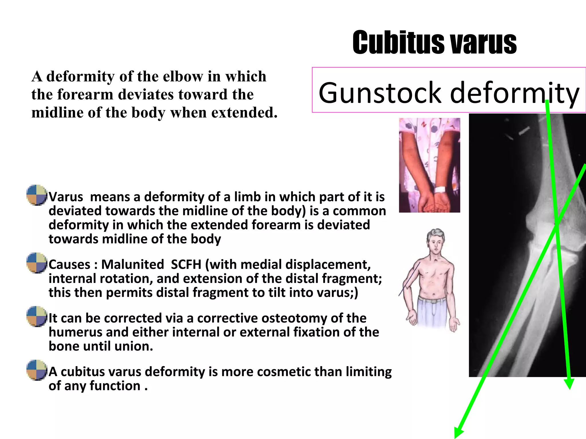 Disorders of upper limb | ODP