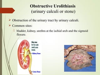 Disorders of urinary system | PPT