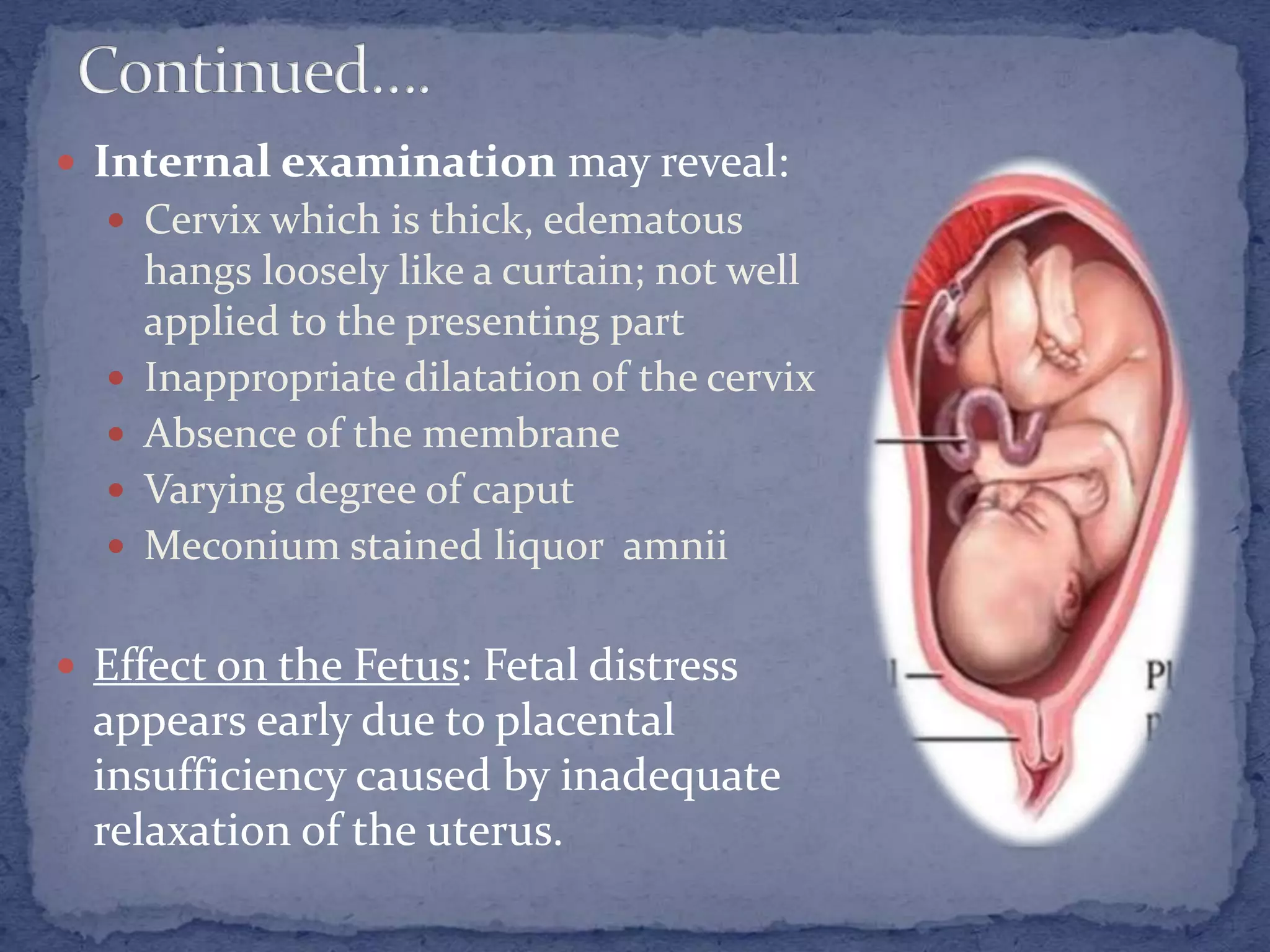 Disorders of uterine contraction, precipitate labor, premature labor ...