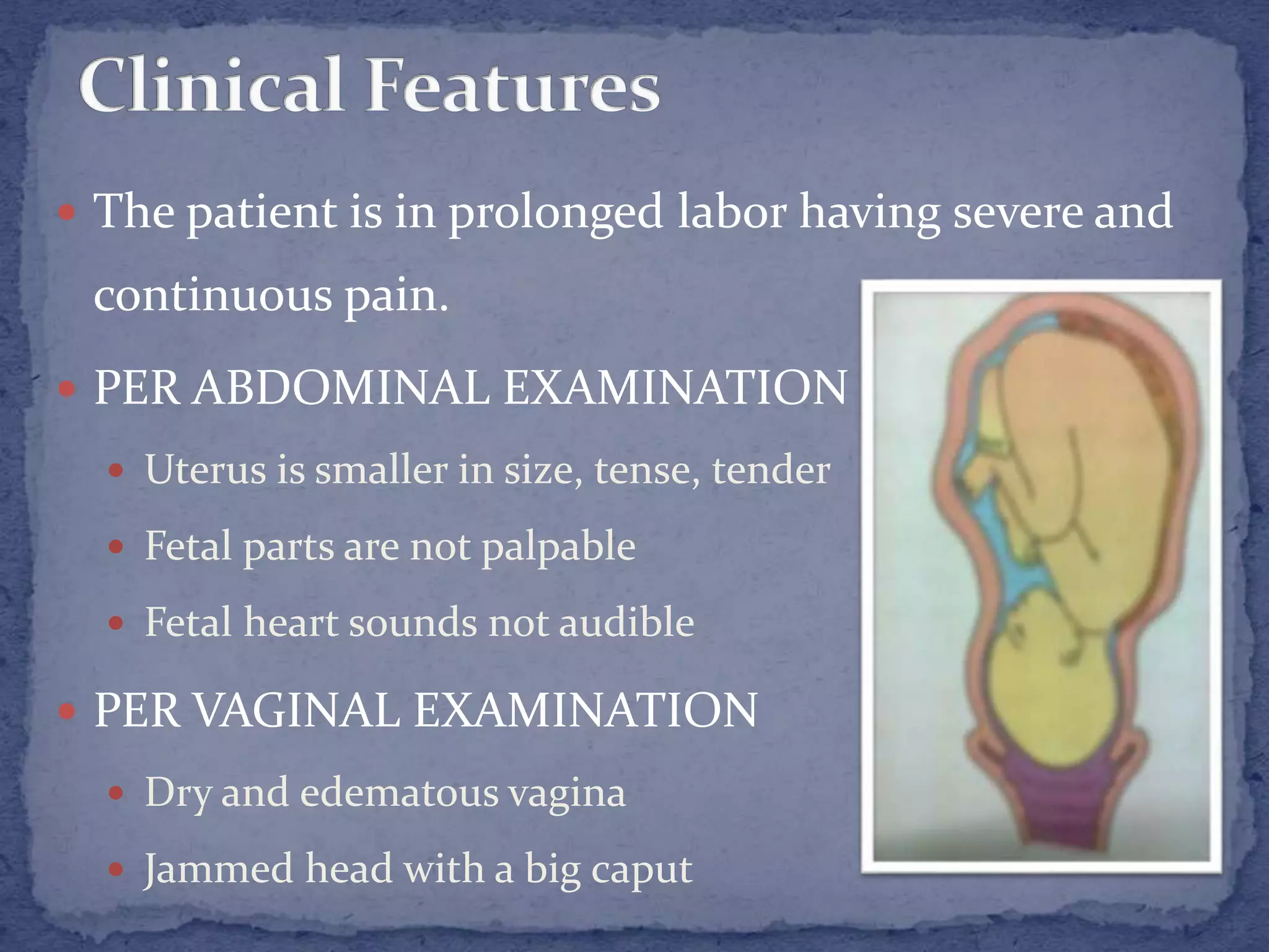 Disorders of uterine contraction, precipitate labor, premature labor ...