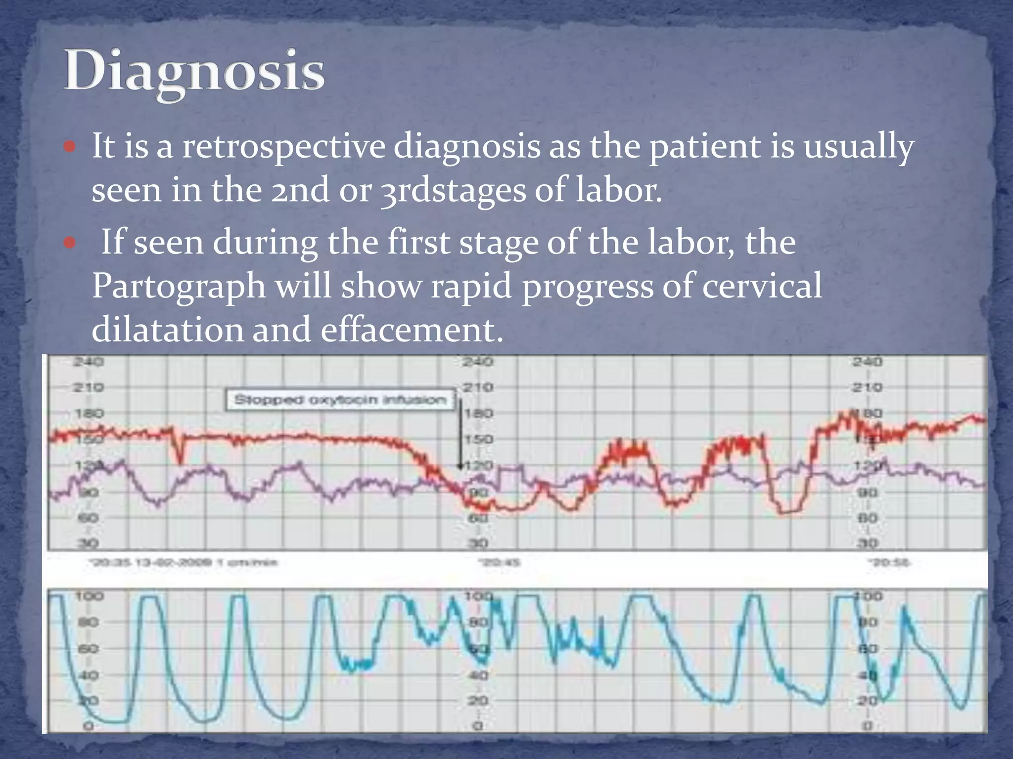 Disorders of uterine contraction, precipitate labor, premature labor ...