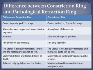 Disorders of uterine contraction, precipitate labor, premature labor ...