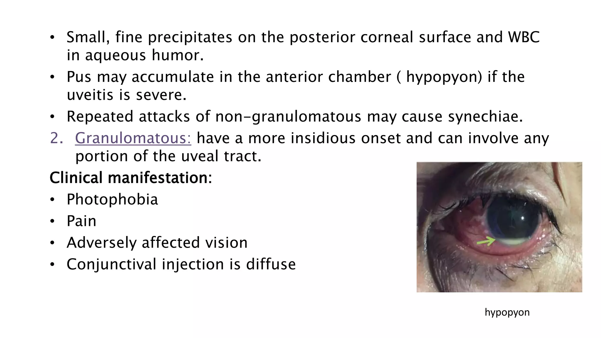 Disorders of uveal tract | PPTX
