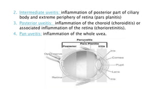 Disorders of uveal tract | PPTX