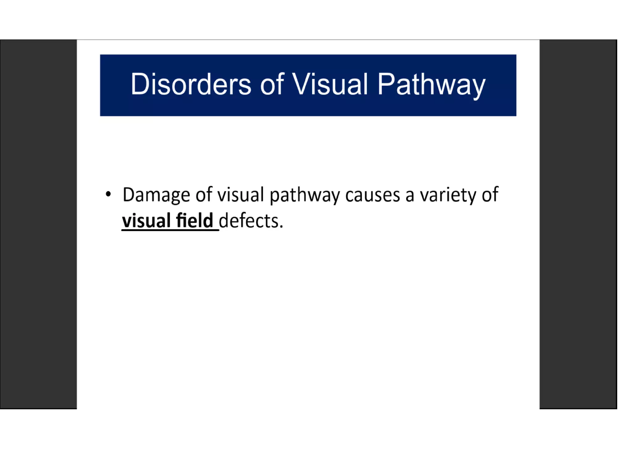 Disorders of visual pathway | PPTX