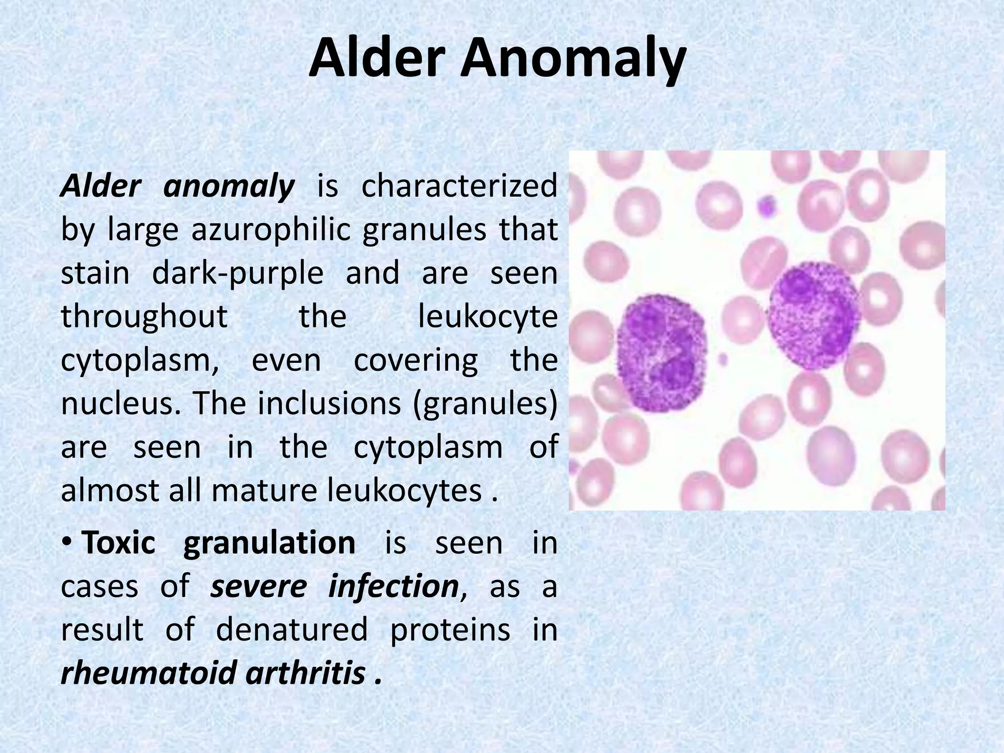 Disorders of white blood cells | PPTX