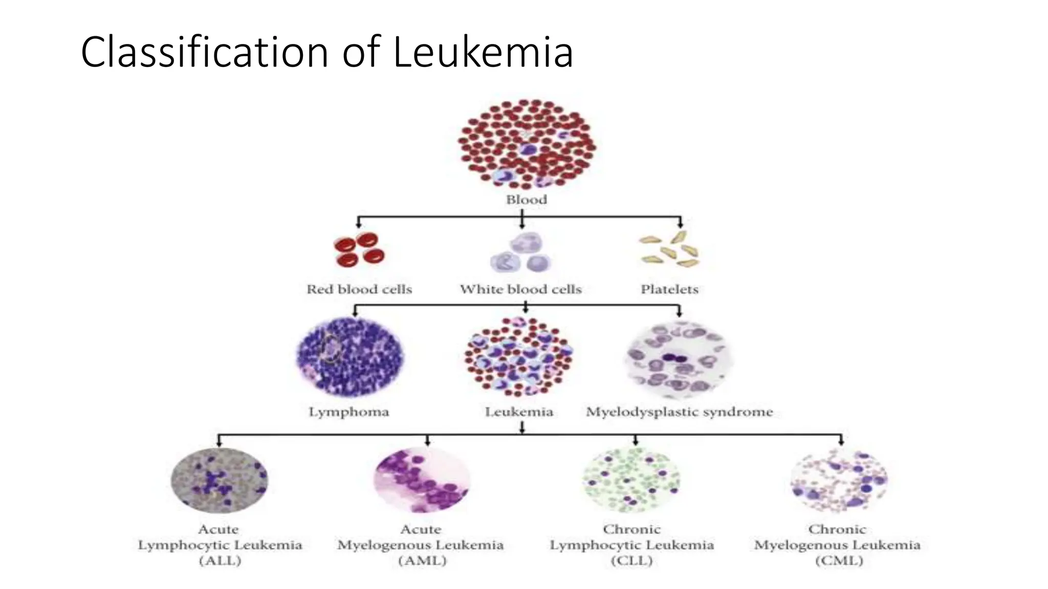 Disorders of white blood cells and related conditions | PPTX