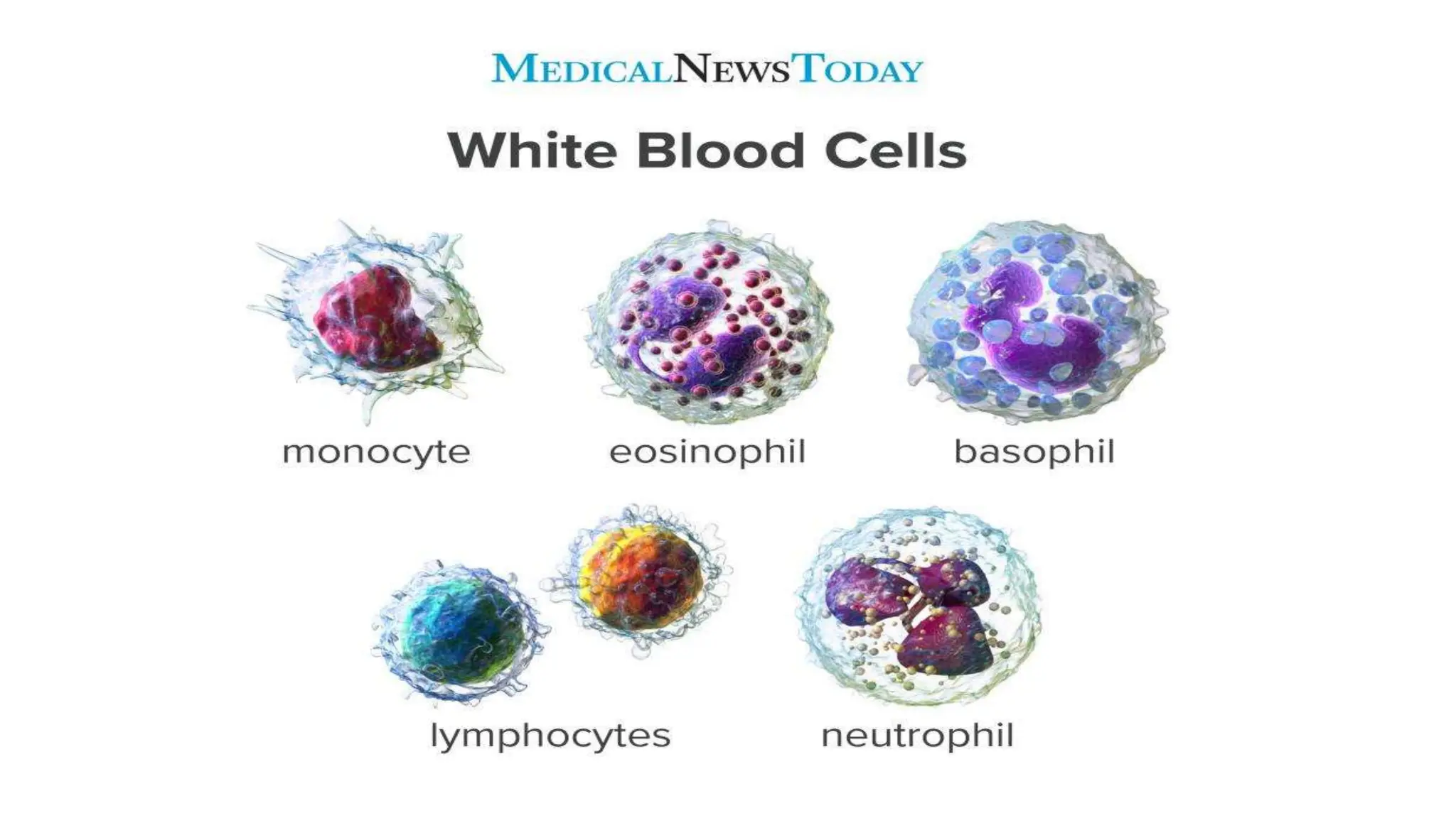 Disorders of white blood cells and related conditions | PPTX