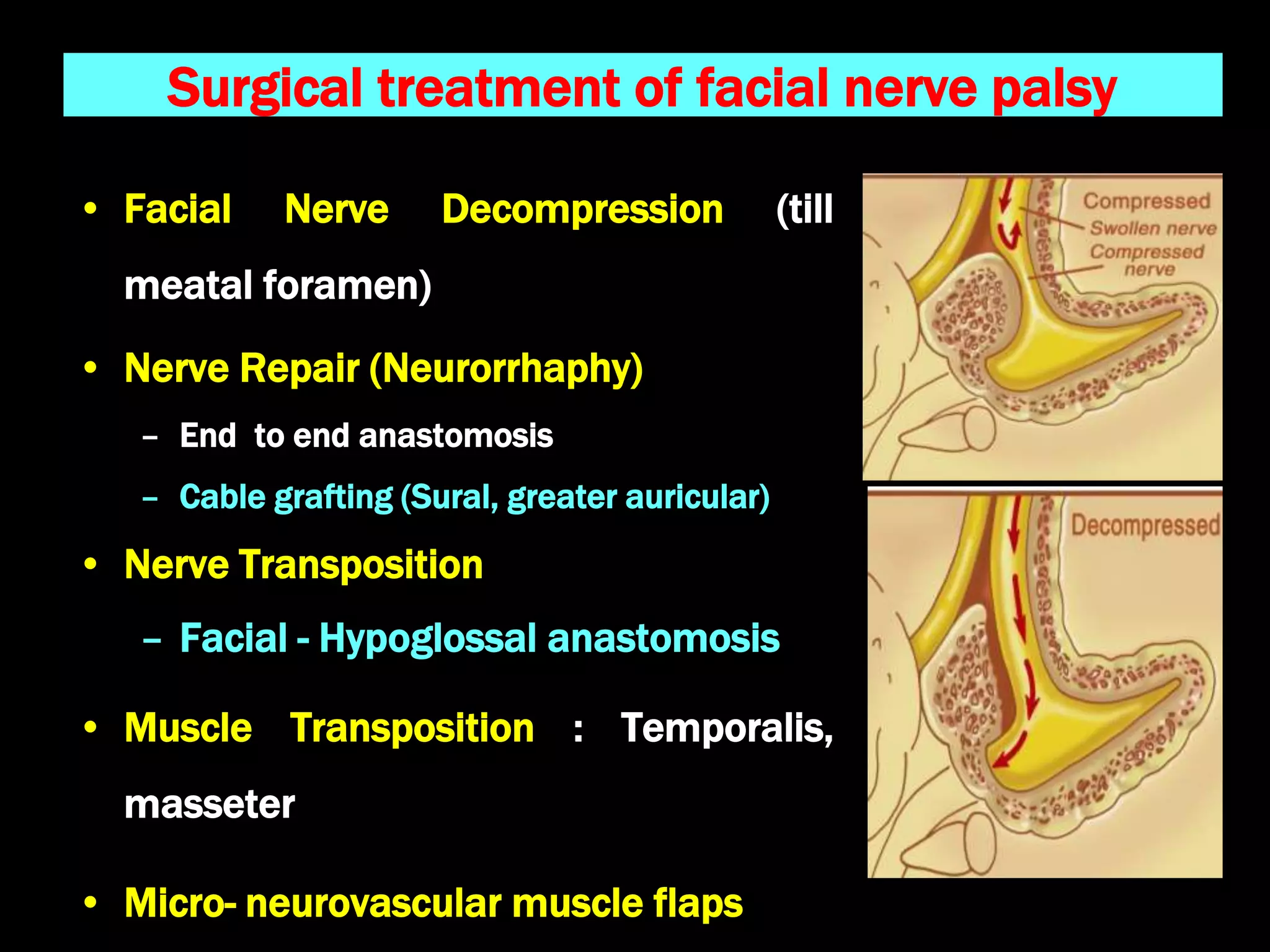 Disorders of facial nerve | PPT