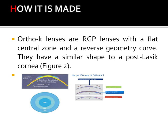 Dispensing of ortho k lenses | PPTX | Eye and Vision Conditions | Diseases and Conditions