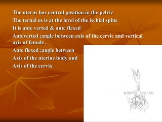 displacement of the uterus.pptx