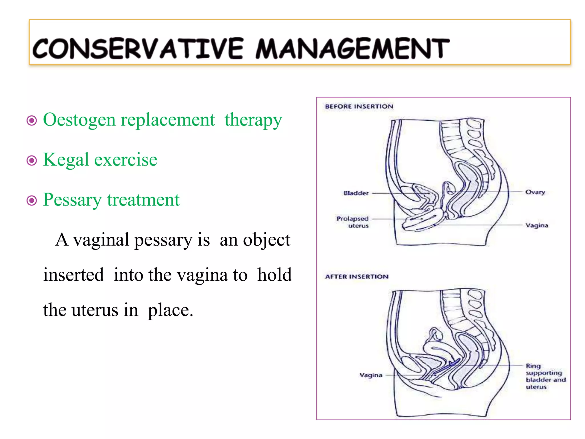 Displacement of uterus | PPTX