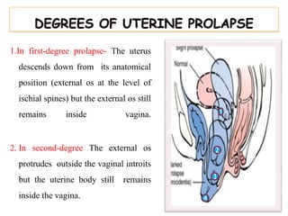 Displacement of uterus | PPT