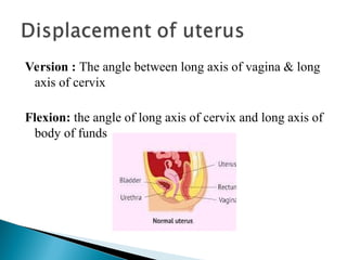 USDISPLACEMENT OF UTER in female body.ppt
