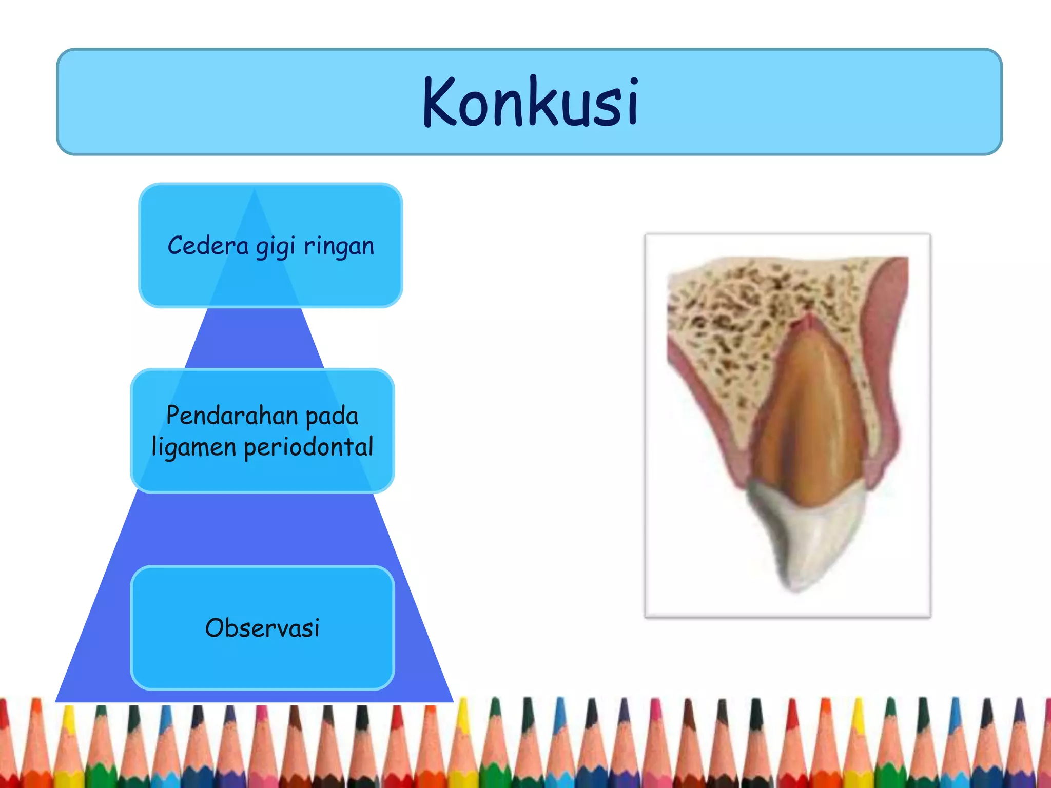 Displacement tooth (traumatic injury on children) | PPTX