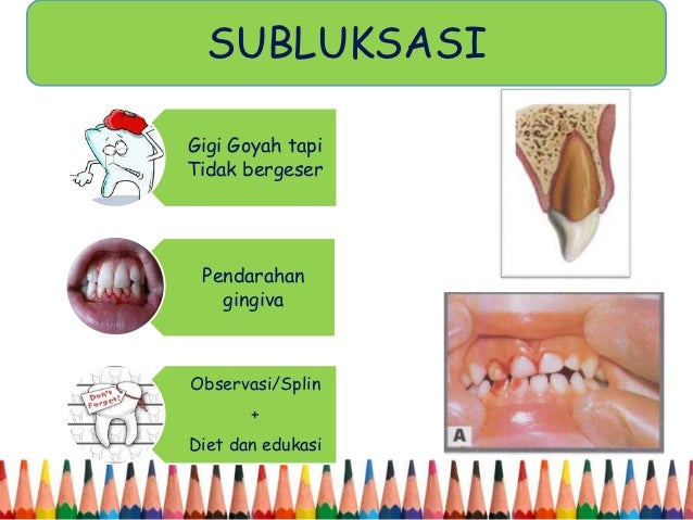 Displacement tooth (traumatic injury on children)
