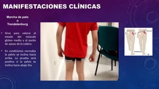displasia de cadera una presentacion del tema | PPTX