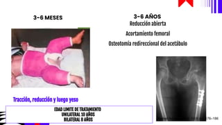 Displasia congénita de cadera abordaje pdf | PDF