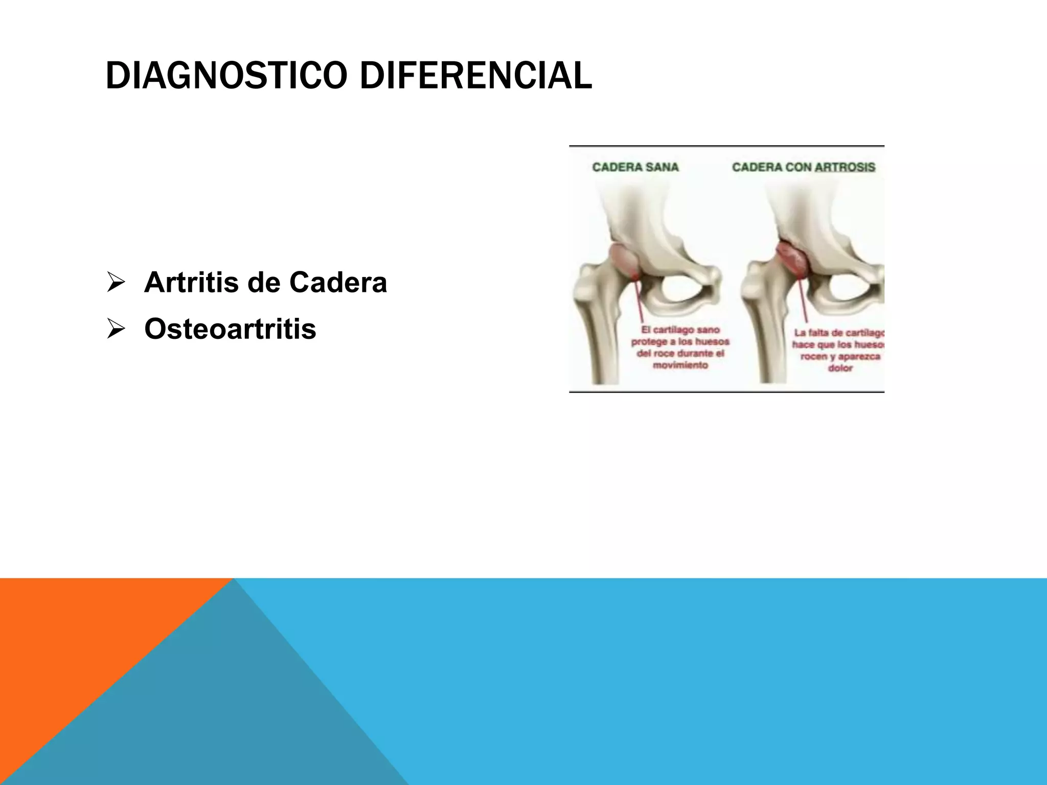 Displasia de cadera | PPT