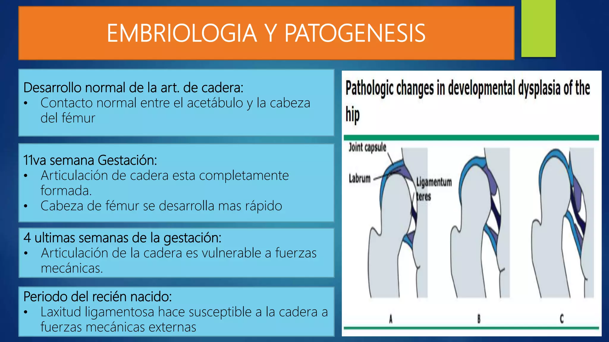 Displasia de desarrollo de cadera/ Luxación Congénita de Cadera | PPTX