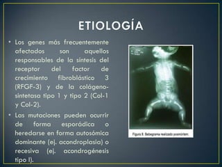 Displasias oseas | PPTX