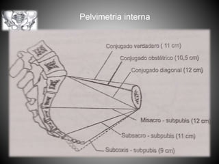 Pelvis ósea obstetricia................. | PPTX