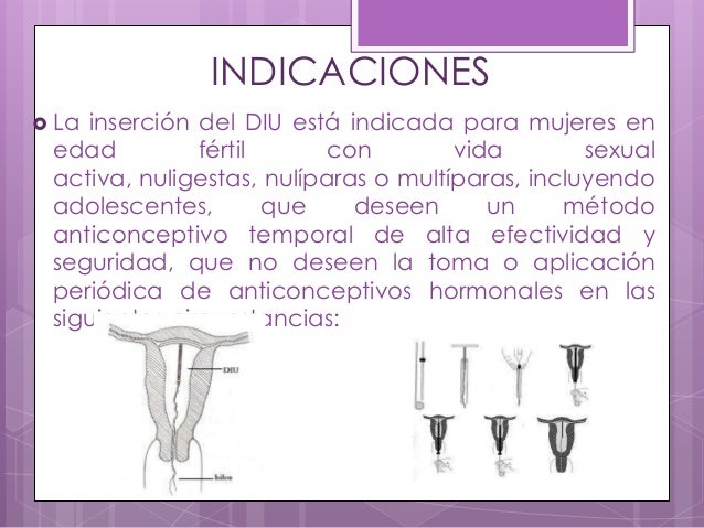 Dispositivo Intrauterino