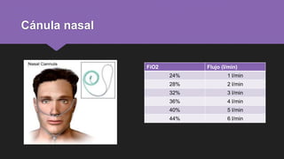 Dispositivos de Oxigenoterapia .pptx