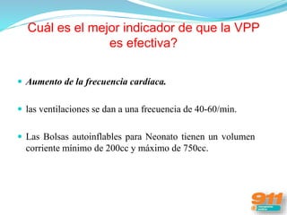 Dispositivos de vpp y compresiones | PPTX