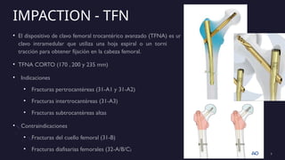 Dispositivos intramedulares en fracturas de cadera.pptx