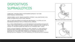 DISPOSITIVOS PARA EL MANEJO DE LA VIA AEREA.pptx