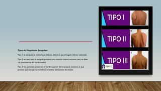 ortopedia y traumatologia Disquinesia Escapular.pptx