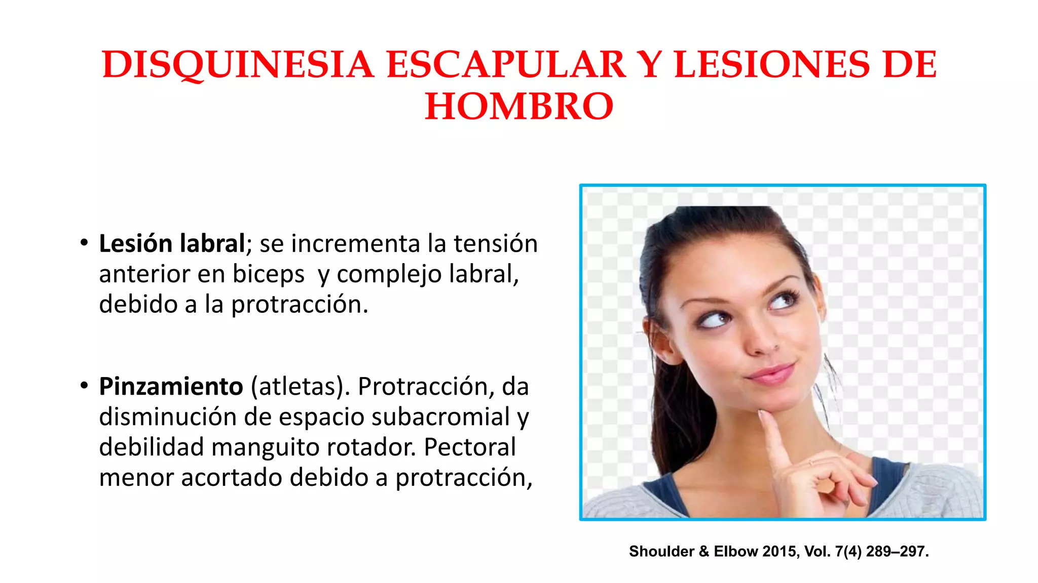 Disquinesia escapular post fractura clavicular | PPTX