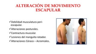 Disquinesia escapular post fractura clavicular | PPTX