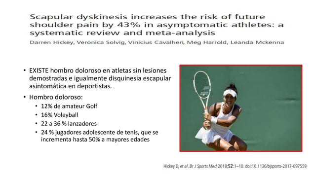 Disquinesia escapular post fractura clavicular | PPTX