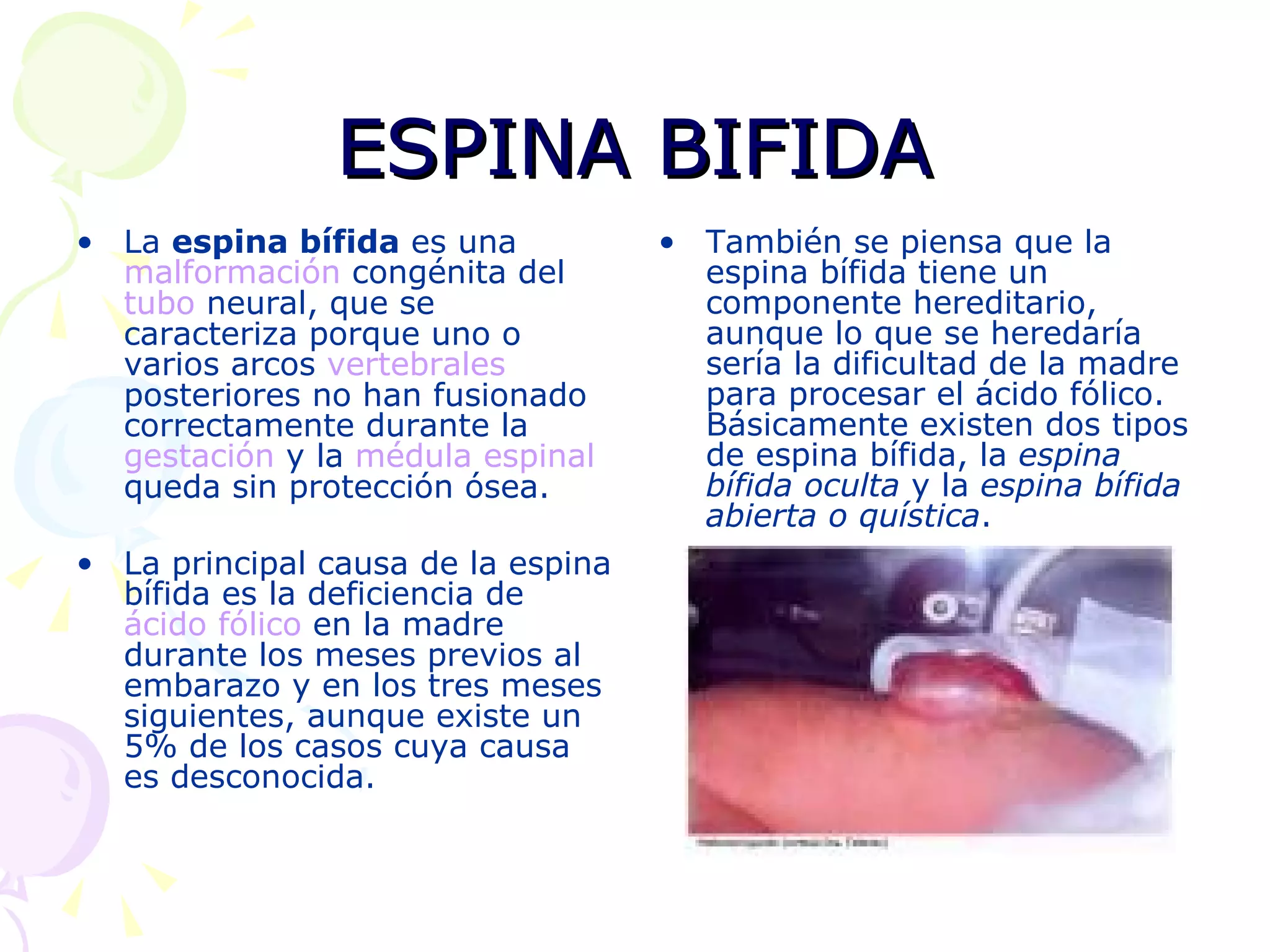 Disrafias espinales y mielomeningocele | PPT