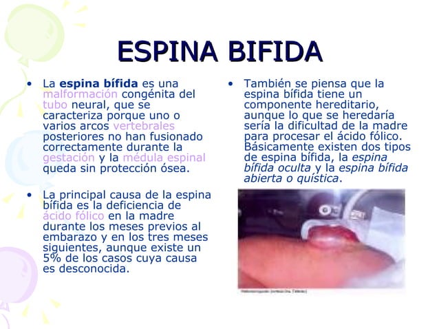 Disrafias espinales y mielomeningocele | PPT
