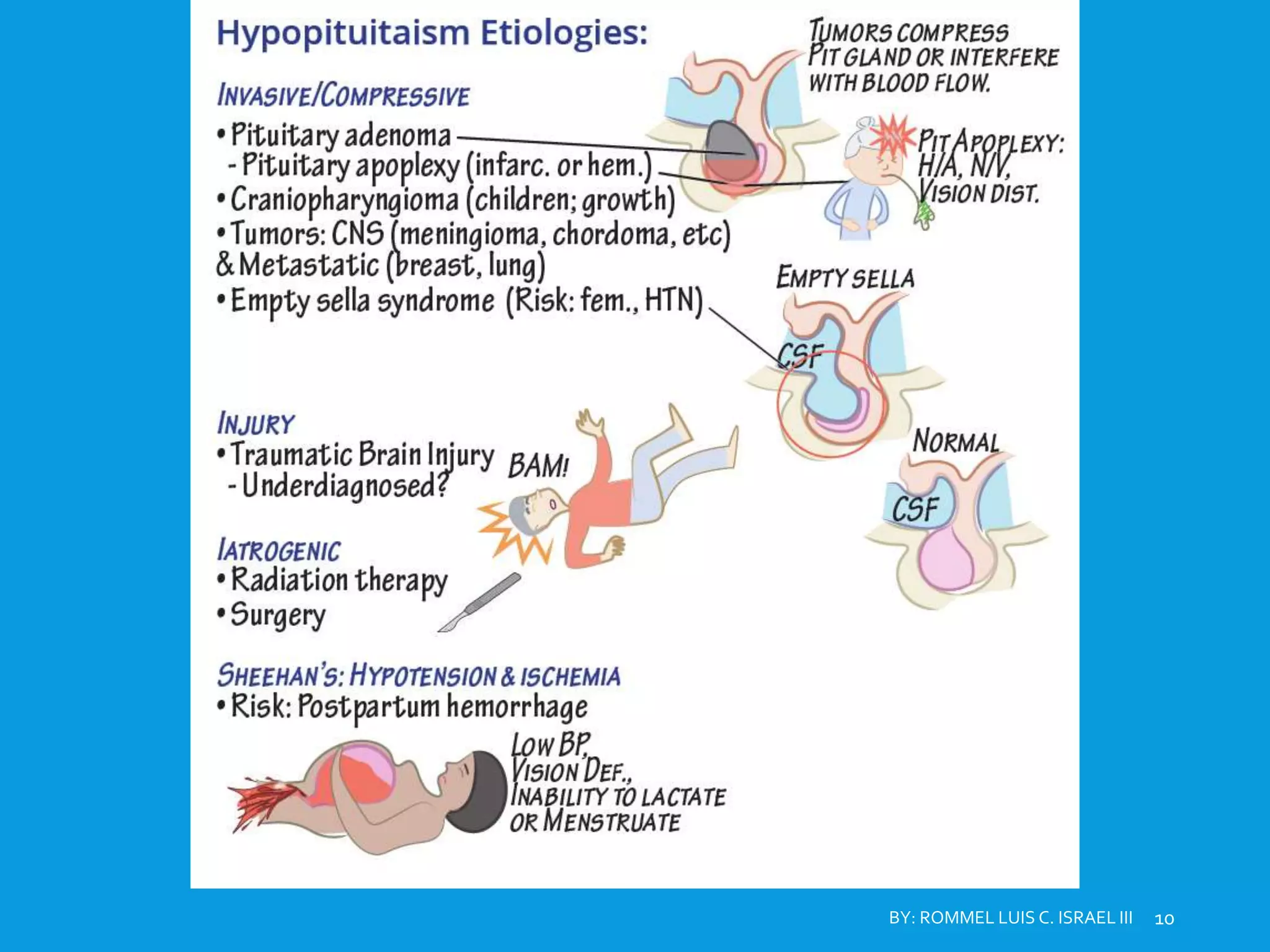 DISORDERS OF THE PITUITARY GLAND | PPT