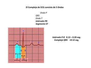 Disrritmias | PPT