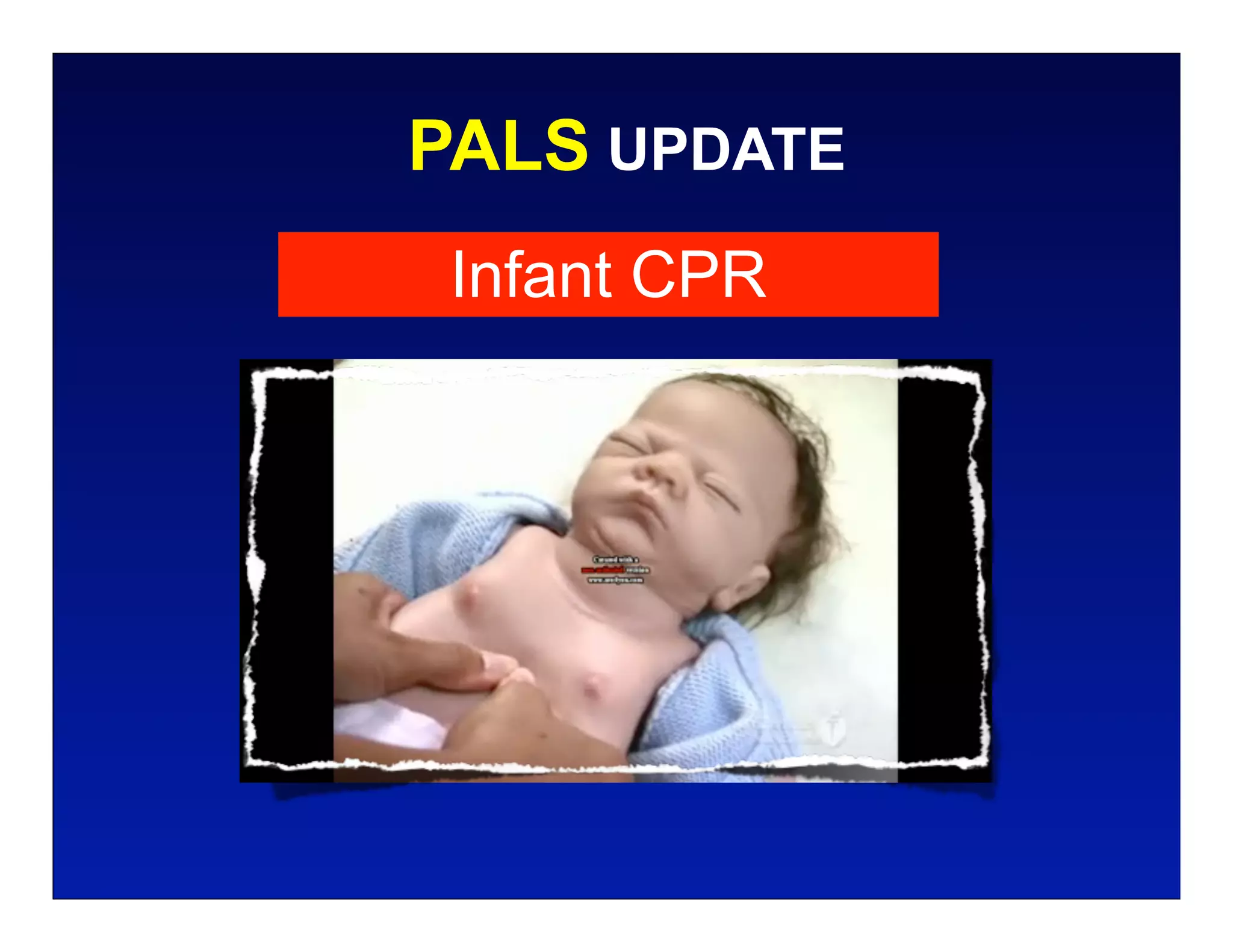Dissecting the Medical Issues in Pediatric Drowning | PDF