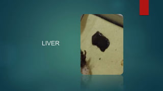 Dissection of frog | PPTX