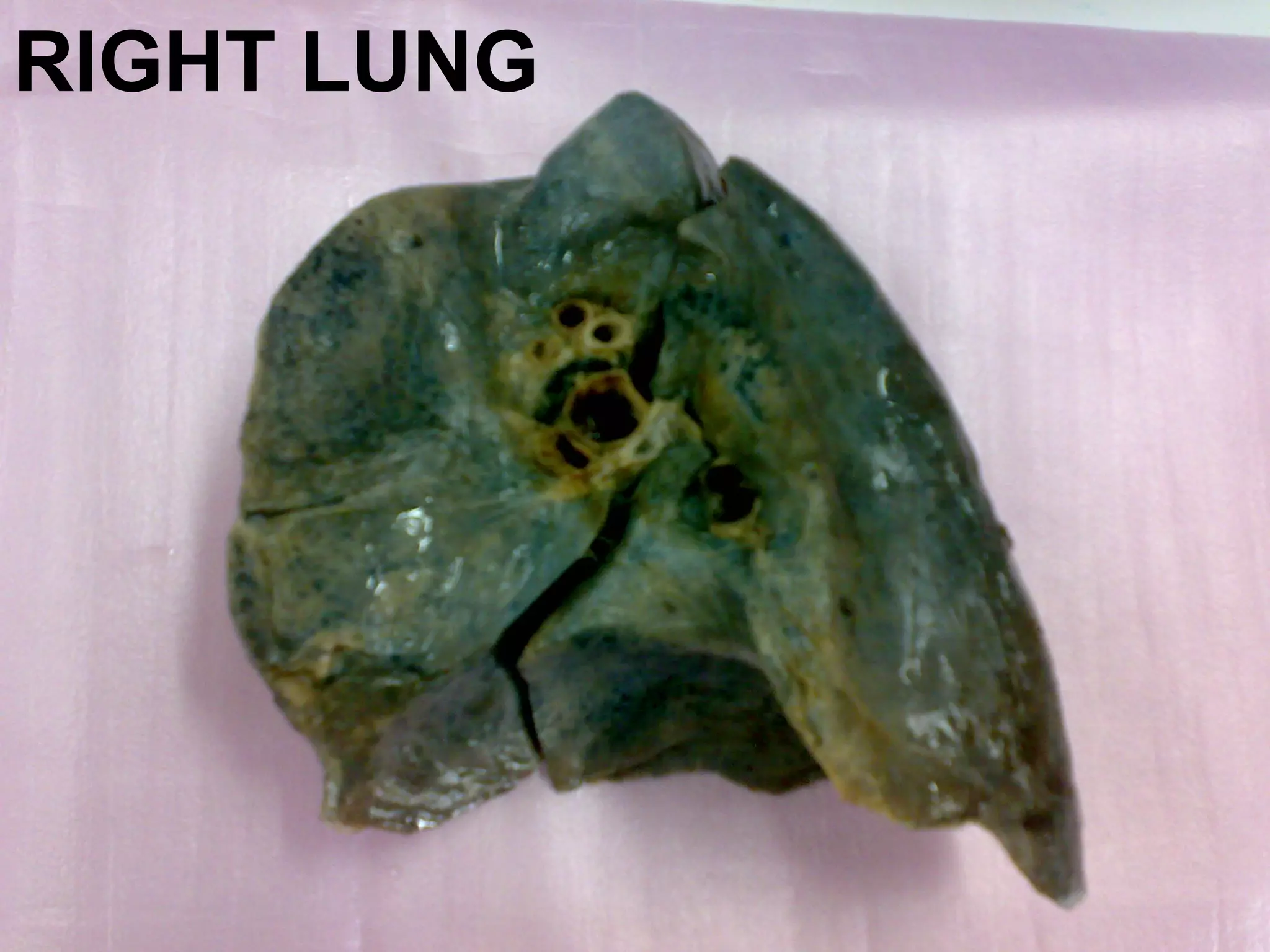 Dissection of heart and lung | PPT