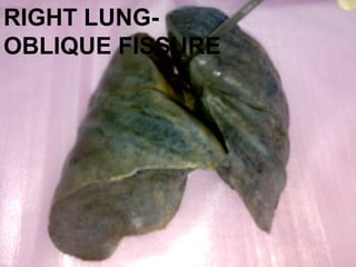 Dissection of heart and lung | PPT