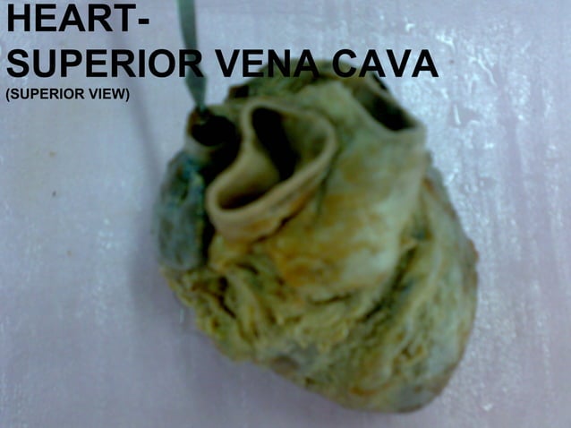 Dissection of heart and lung | PPT