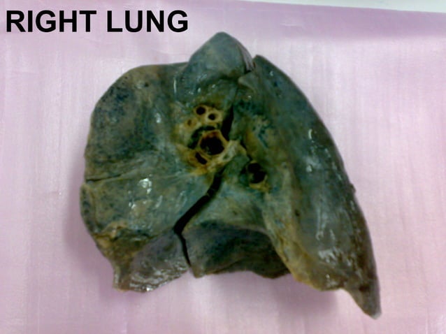 Dissection of heart and lung | PPT