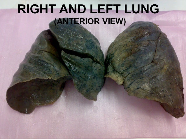 Dissection of heart and lung